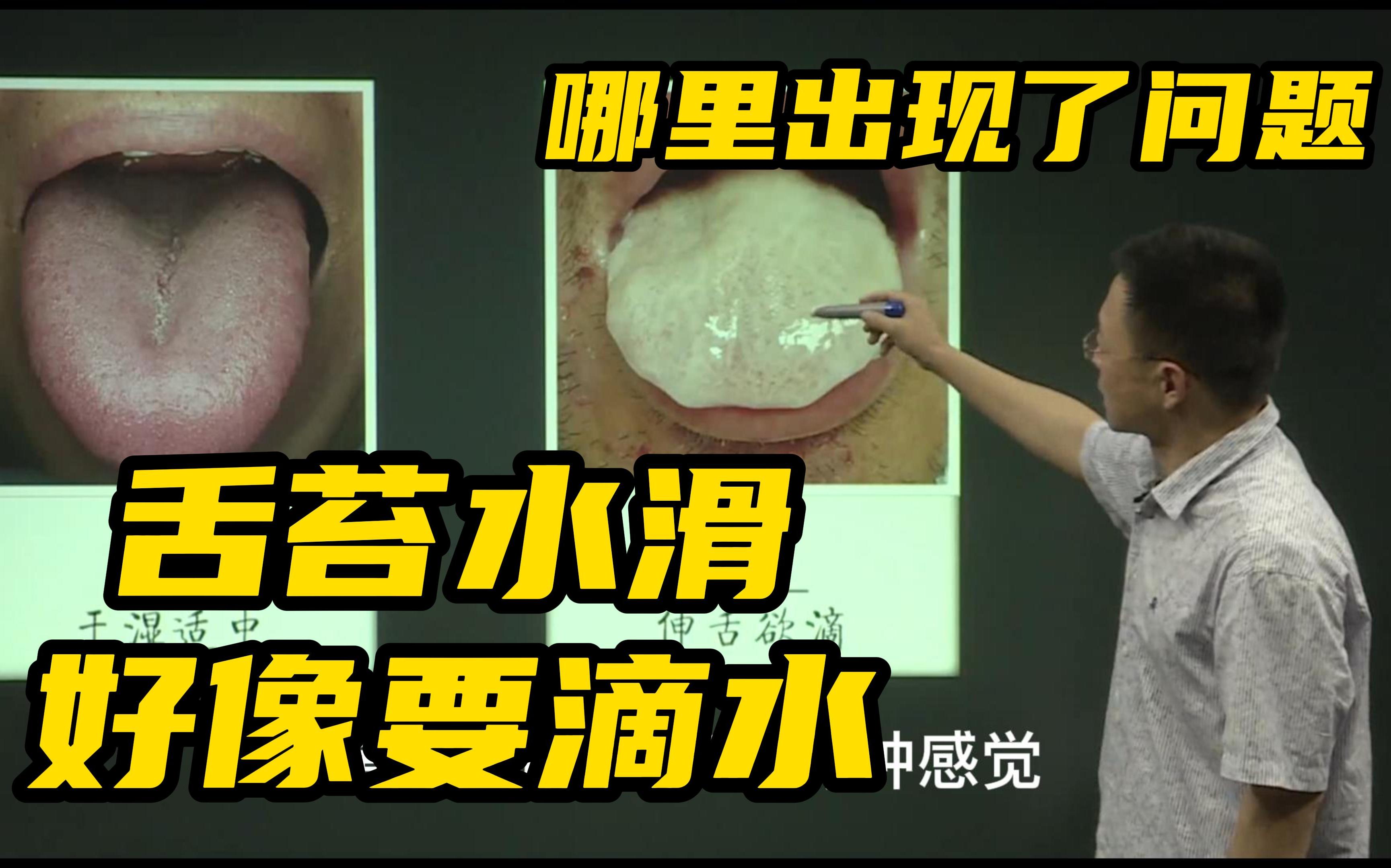 舌苔水滑,好像要滴水,是哪里出现了问题