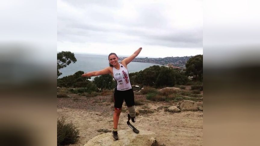 乐观截肢女孩微笑依然美丽,身体残疾同样可以活的精彩!