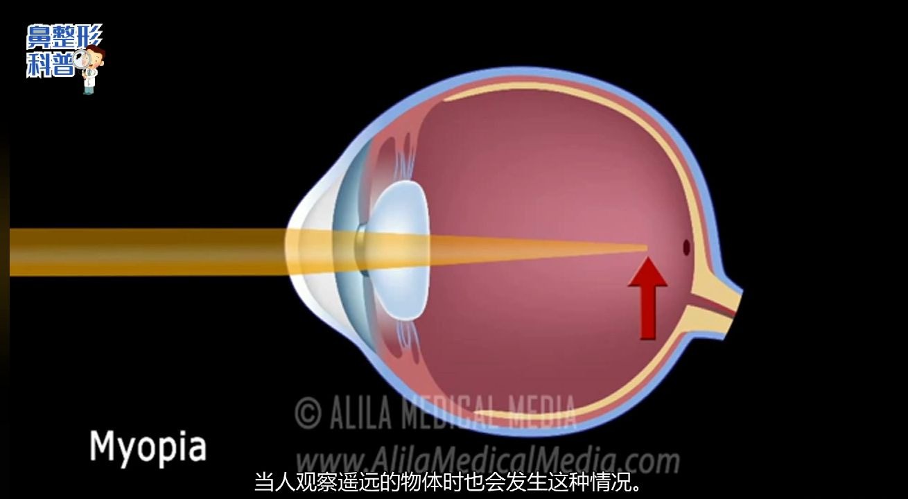 眼球近视远视成因及眼球的结构、成像原理