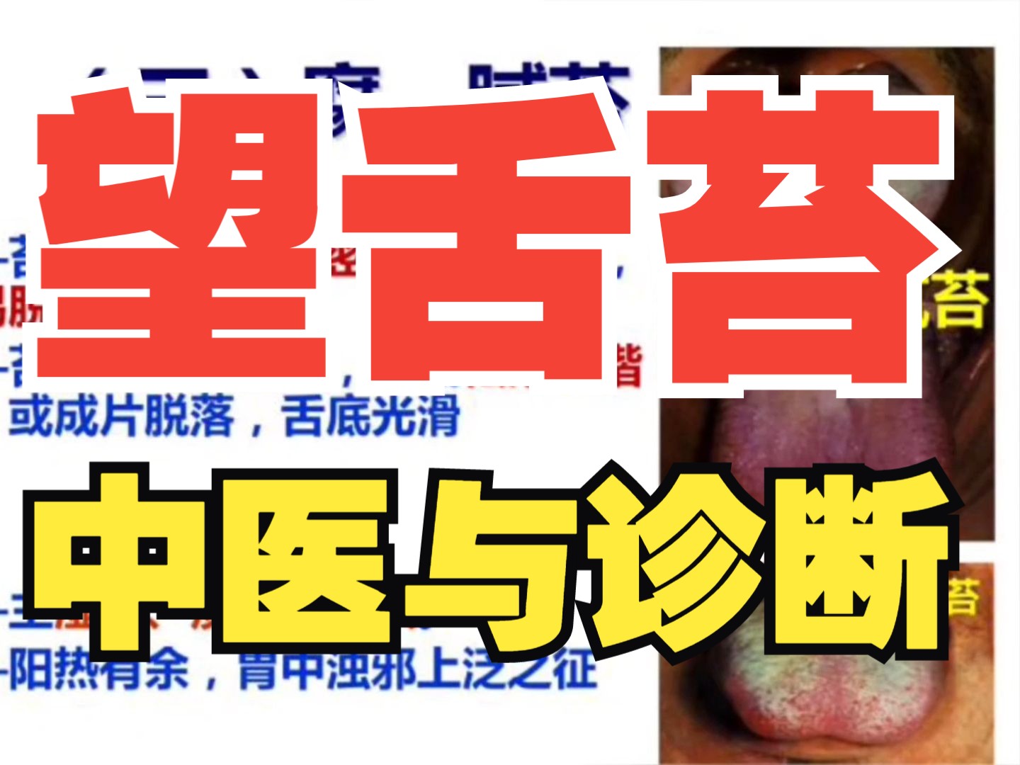 中医与诊断:望舌苔苔色