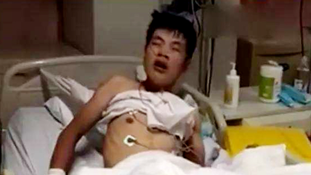 西安女子被流浪狗咬伤 注射疫苗后狂犬病发作死亡