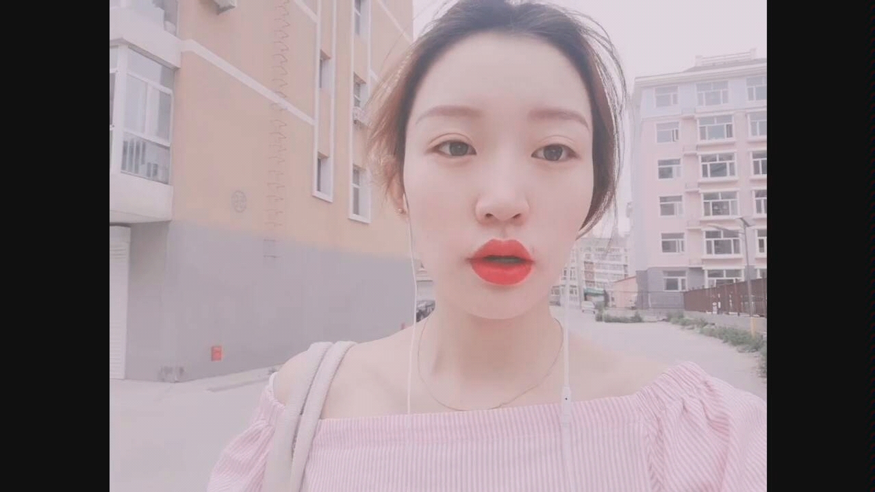 牙齿矫正后期要做什么之换钢丝