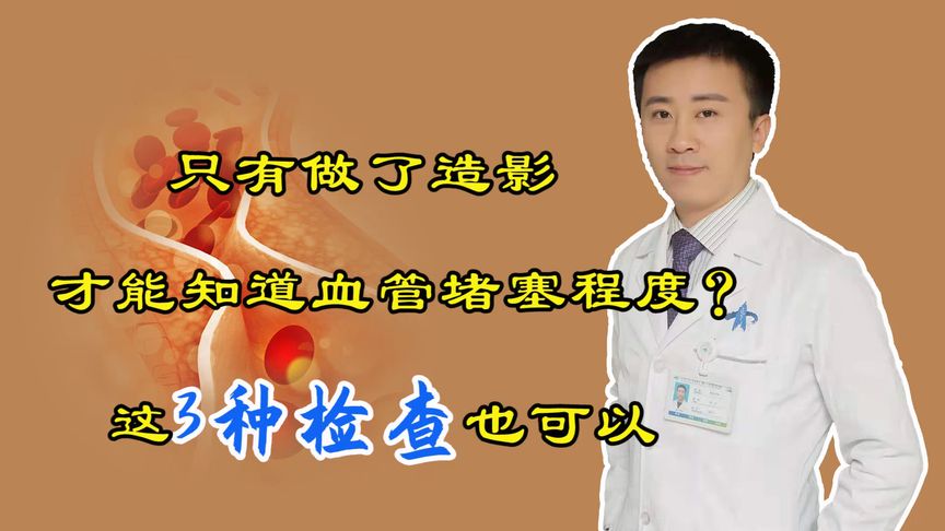 只有造影才能知道血管堵塞的程度?医生:这3种检查一样可以