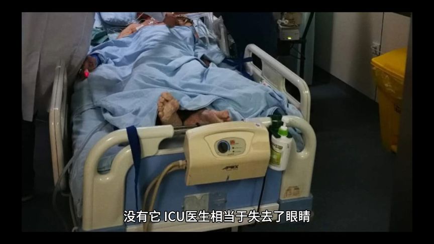 ICU“神器”之床旁血气分析仪