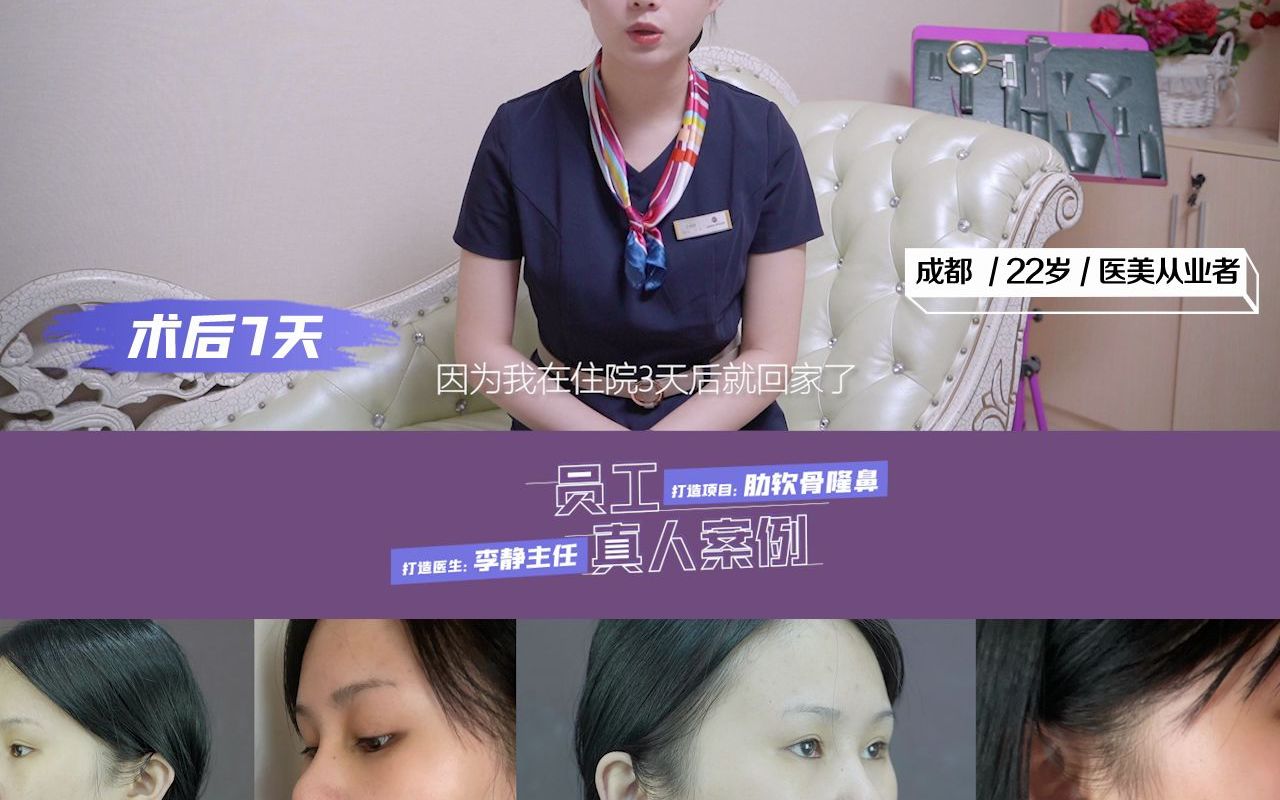 成都美容整形医院—前厅整形小姐姐的术后采访