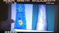 砭石刮痧板的功效