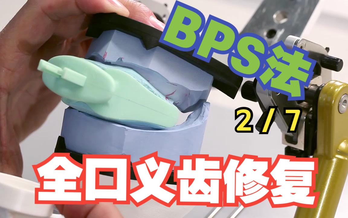 Ivoclar BPS法全口义齿修复全流程——intraoral registration(2/7)