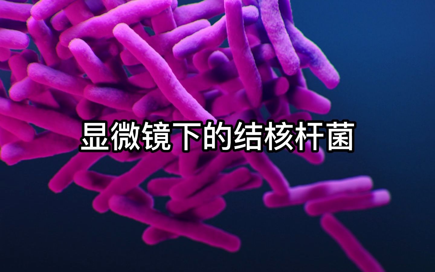 显微镜下的结核杆菌