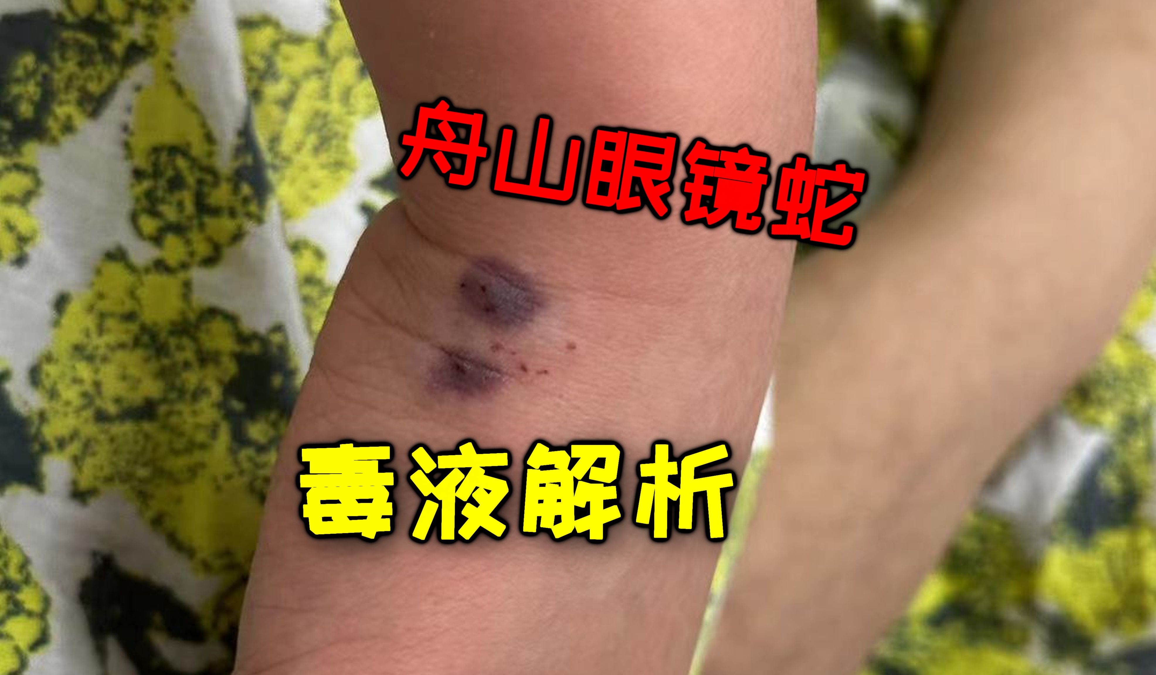 中国十大毒蛇之一!舟山眼镜蛇毒液解析!为什么舟山咬人比咬动物菜的...