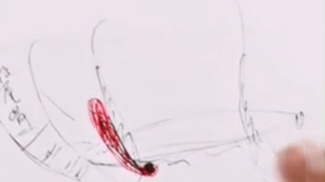 北京复兴路门诊中医肛肠分享肛瘘的瘘管走向图