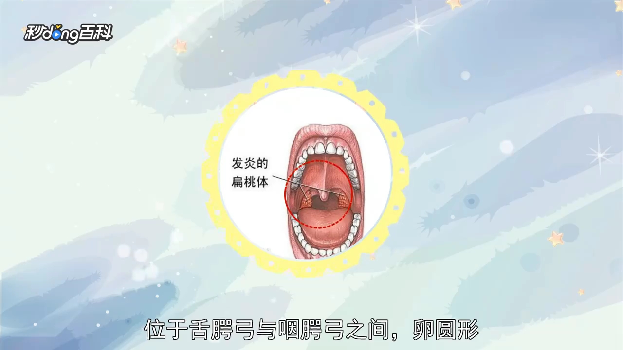 扁桃体:一对扁卵圆形的淋巴器官