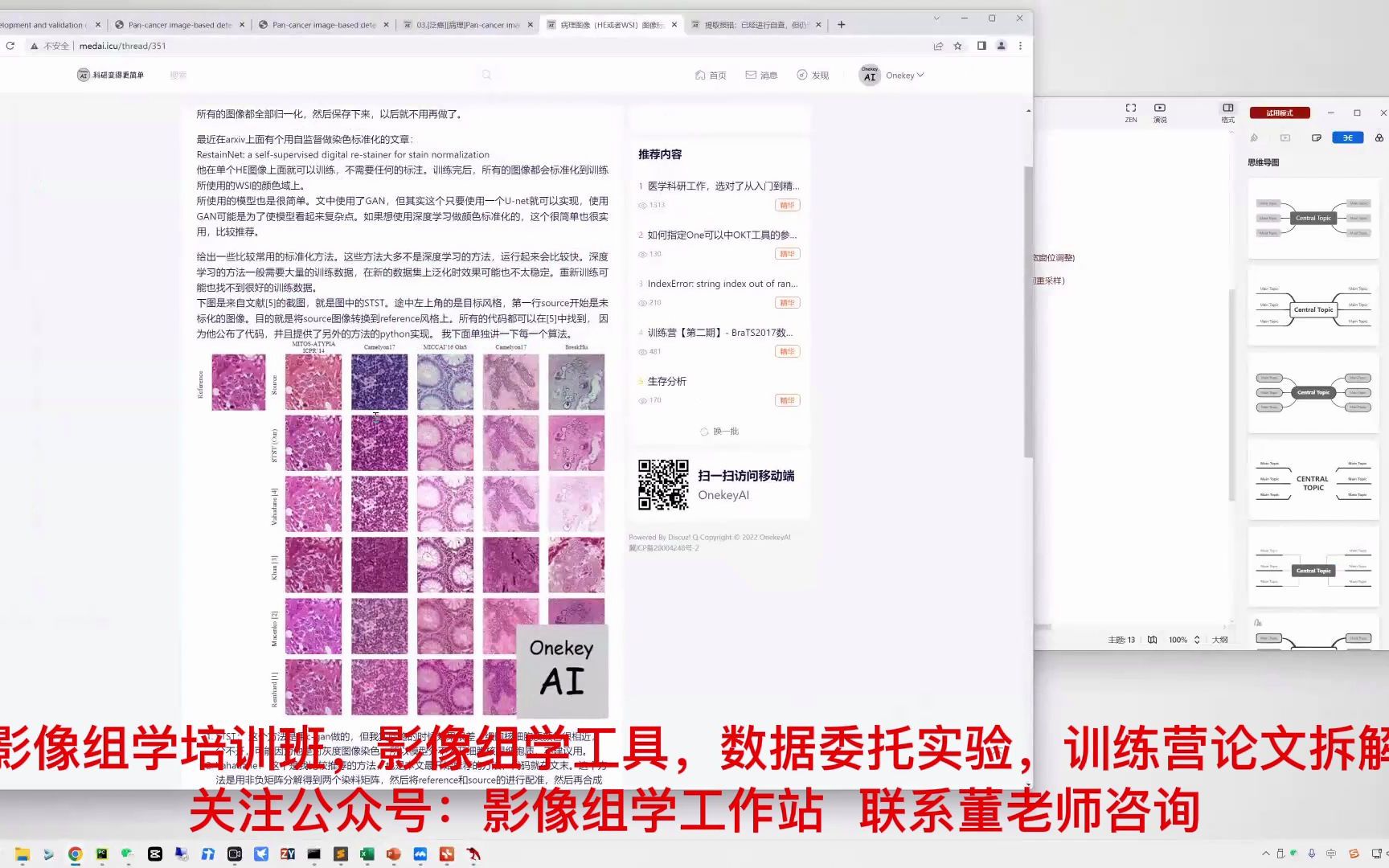 影像组学平台:快速完成影像数据的归一化,重采样