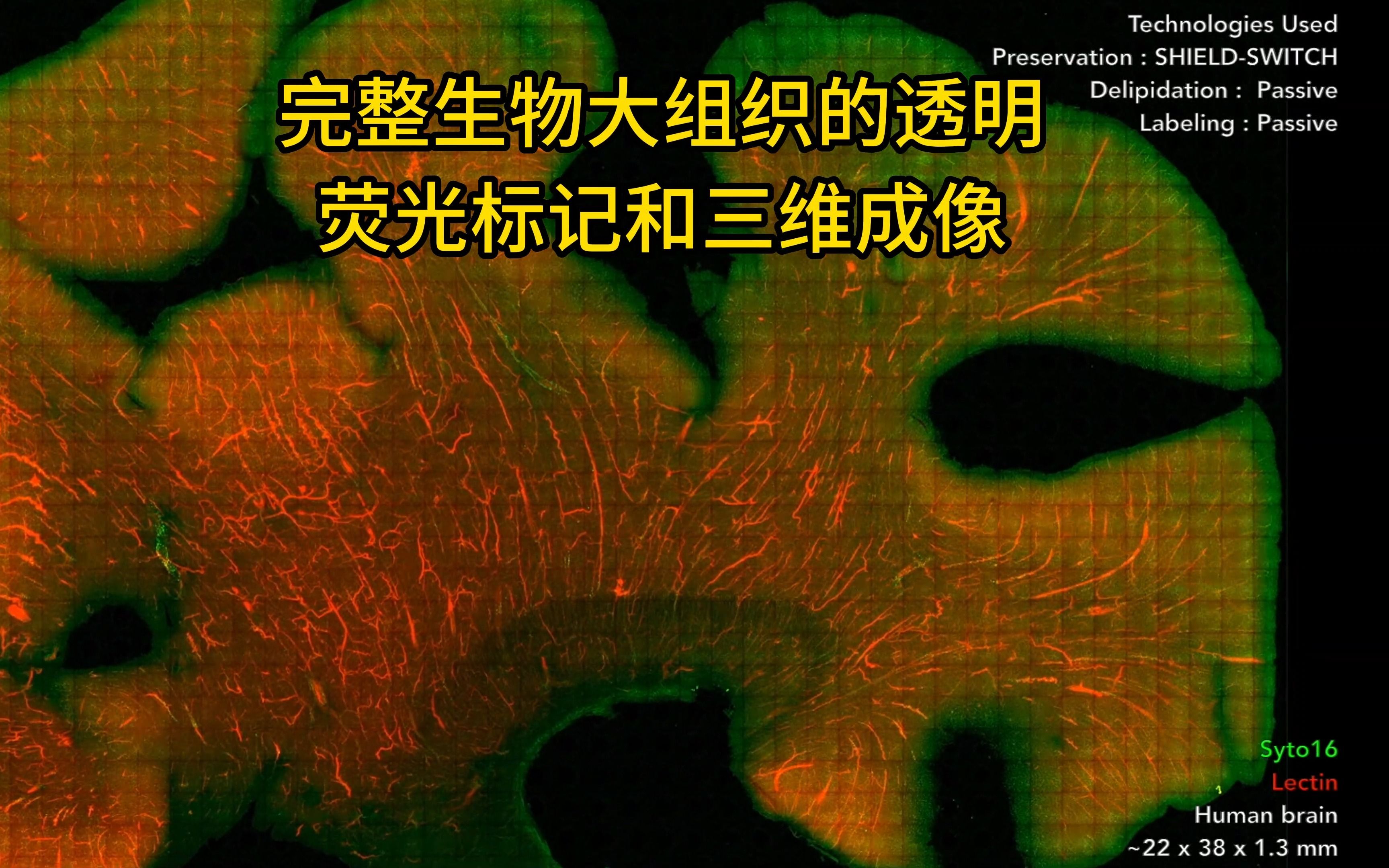 前沿成像技术,SHIELD组织透明化及免疫荧光标记解决方案