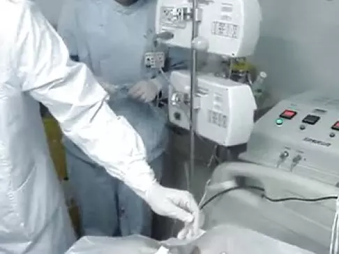 经皮气管切开术