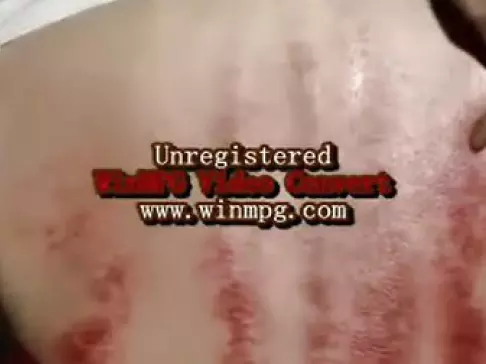 张秀勤老师讲解全息经络刮痧法(上集)