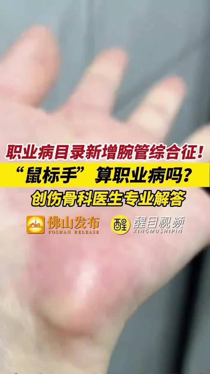 职业病目录新增腕管综合征!"鼠标手"算职业病吗?创伤骨科医生专业解答