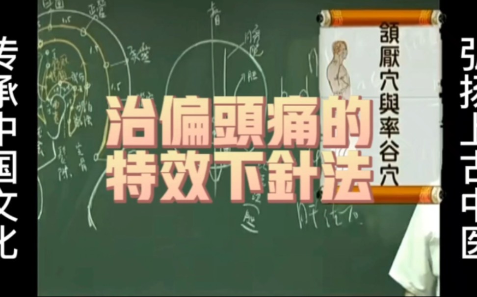 倪师教你治疗偏头痛的特效下针法:太阳透率谷立刻见效