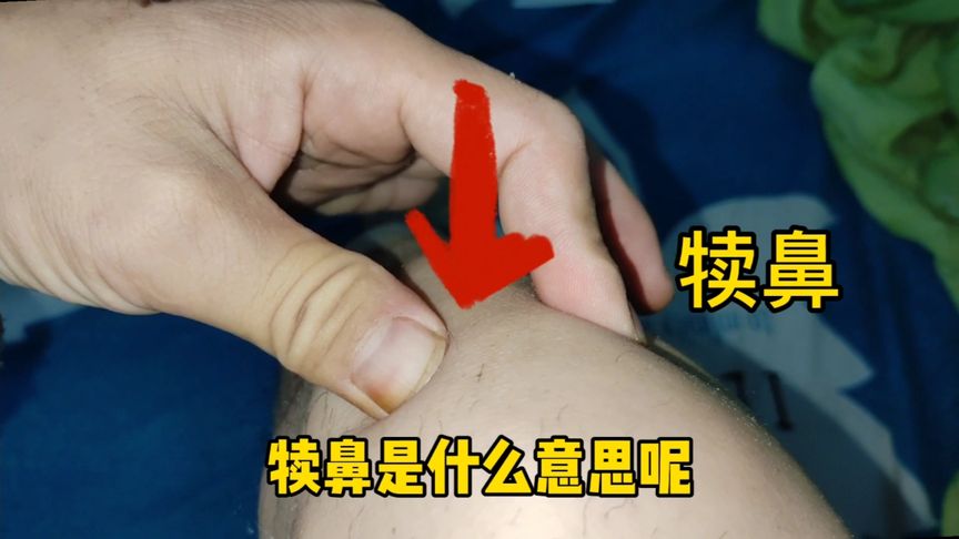 足三里快速正确定位,和安全艾灸技巧分析