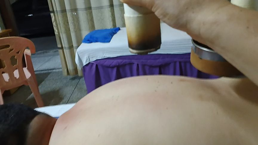 艾灸降糖穴～胰俞穴