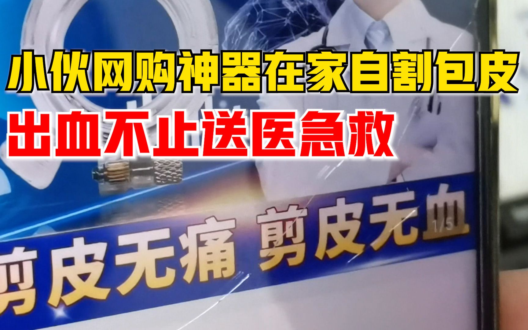 小伙网购神器自割包皮出血就医,医生:很多自己割的,没一例成功