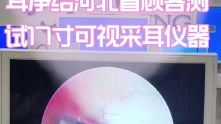 ...版】一键定格款,录像拍照款【可储存导出回放功能】医用主机款多种型