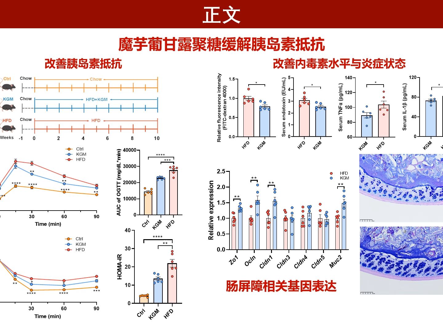 iMeta | 南昌大学聂少平团队揭示葡甘露聚糖通过调节肠道共生菌改善...