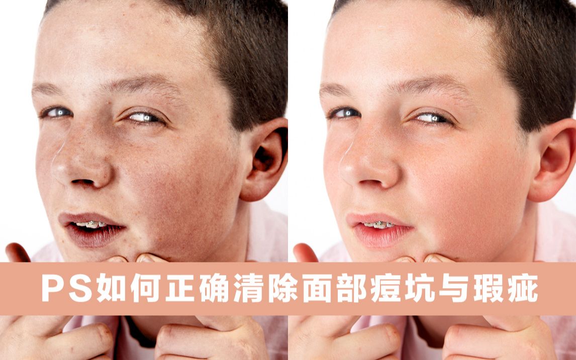 [JUDGEmeTV] Photoshop高级人像精修 | 如何正确清除皮肤痘印和瑕疵