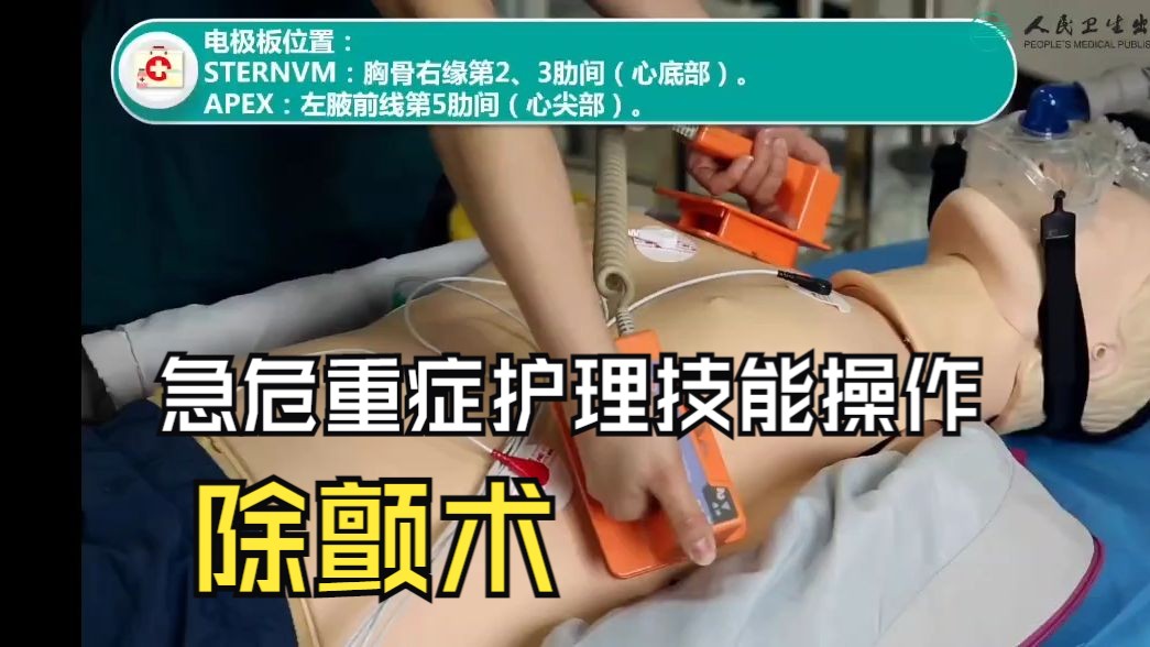 急危重症护理技能操作 除颤术