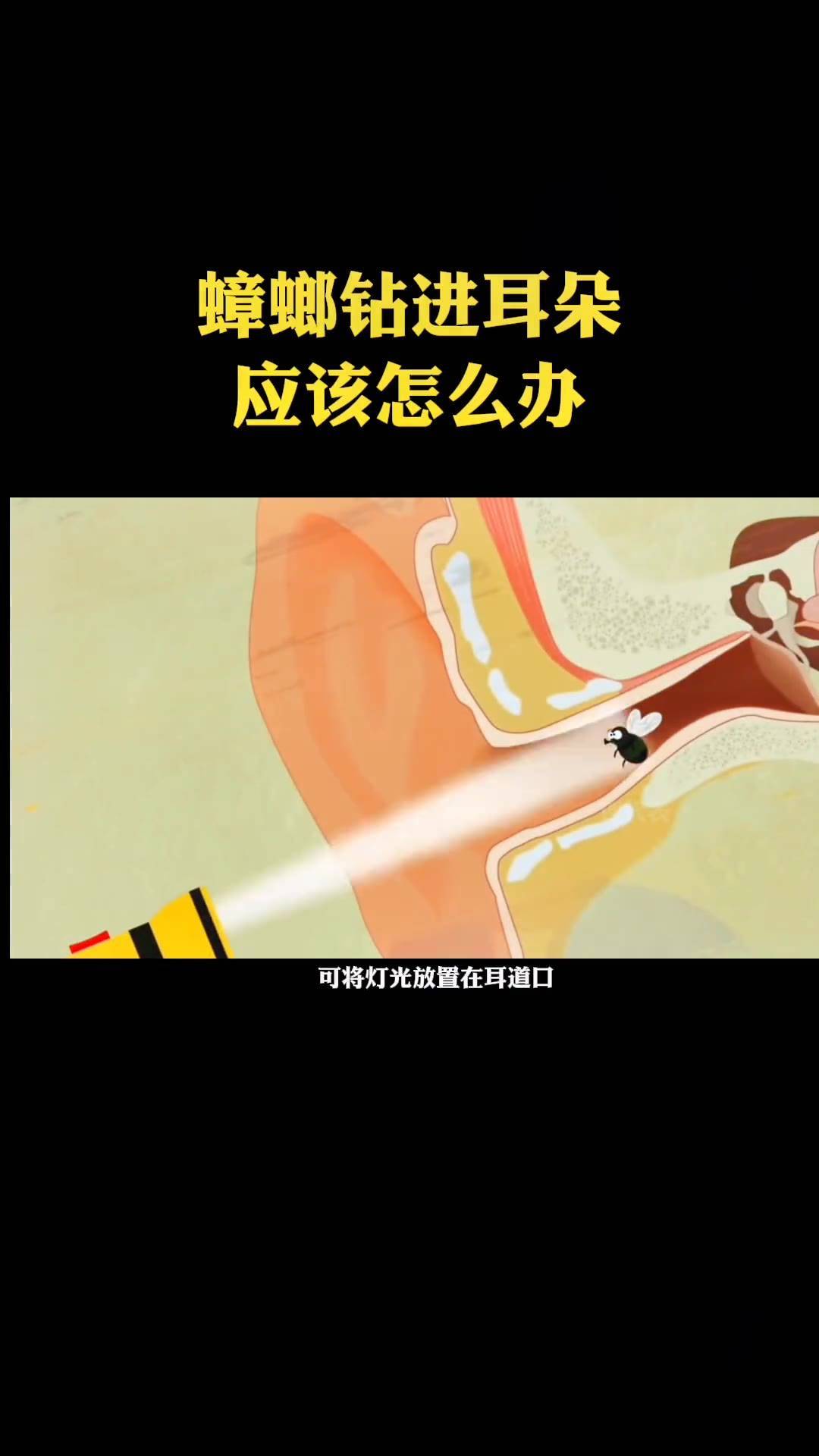 紧急自救指南!蟑螂入侵耳朵?秒懂这5步安全应对策略