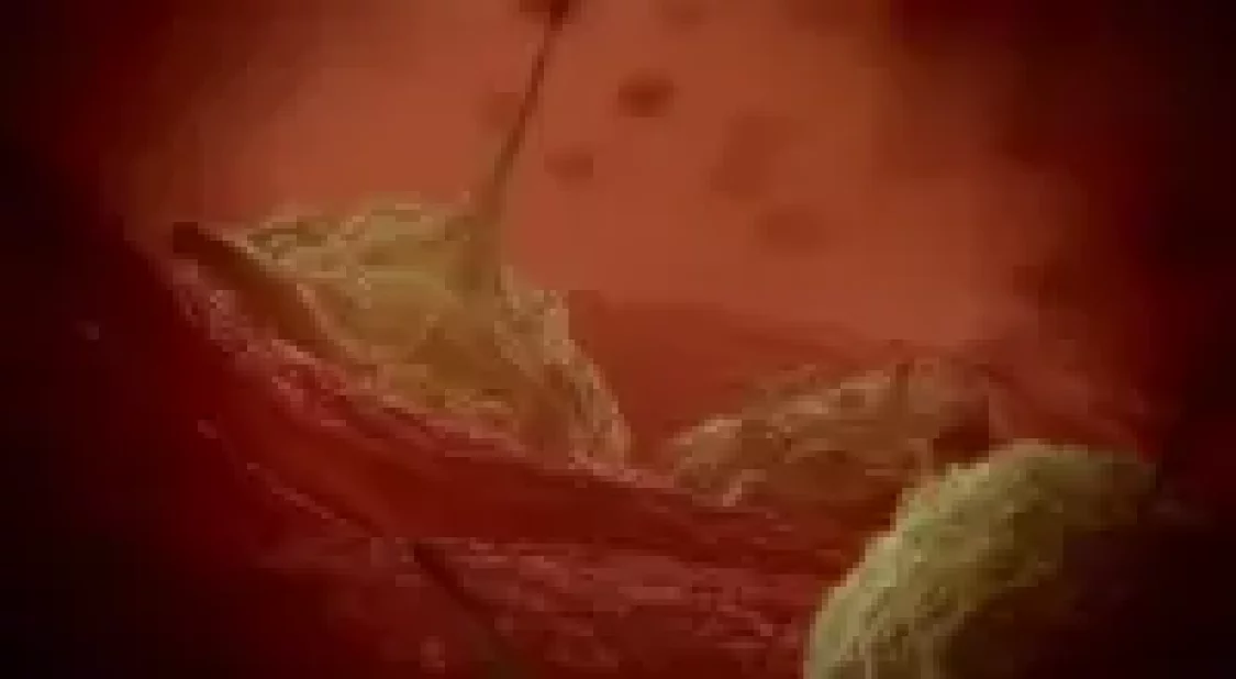 人体为什么会感冒发烧? 人体抵抗感冒病毒入侵的过程