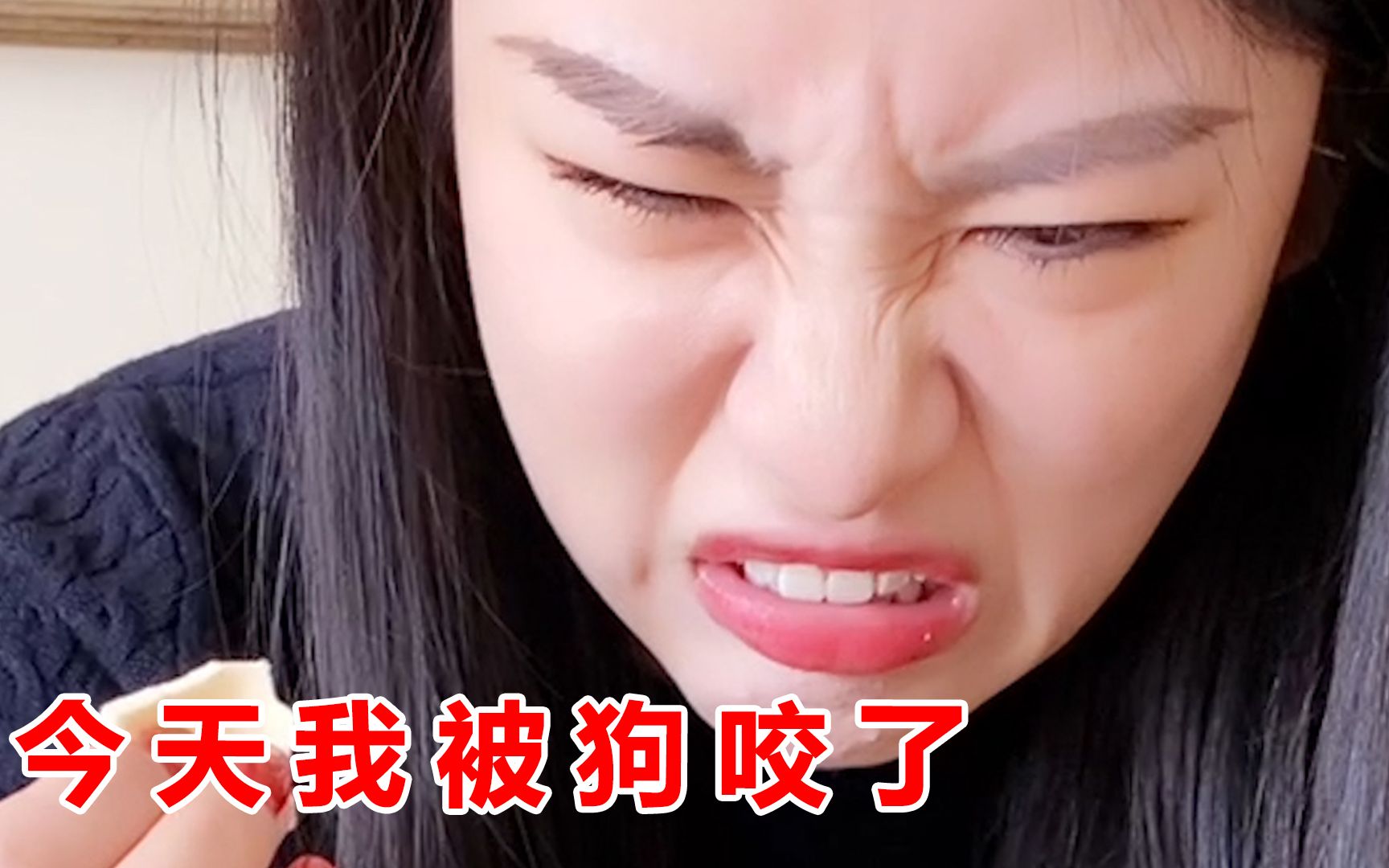 【祝晓晗】被狗咬有什么“症状”?