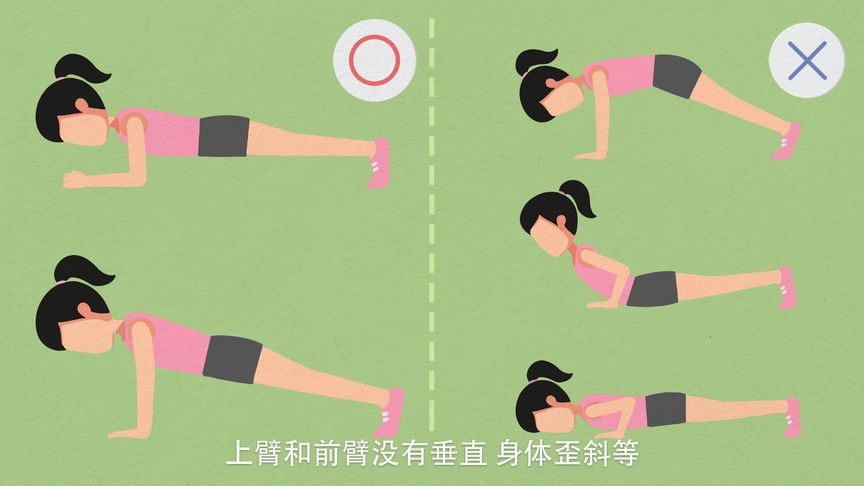 平板支撑,有什么健康益处?哪些人不适合训练?