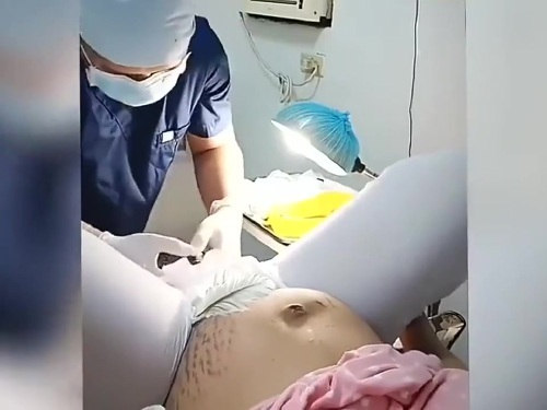 分娩奇迹:妈妈勇敢生产全过程