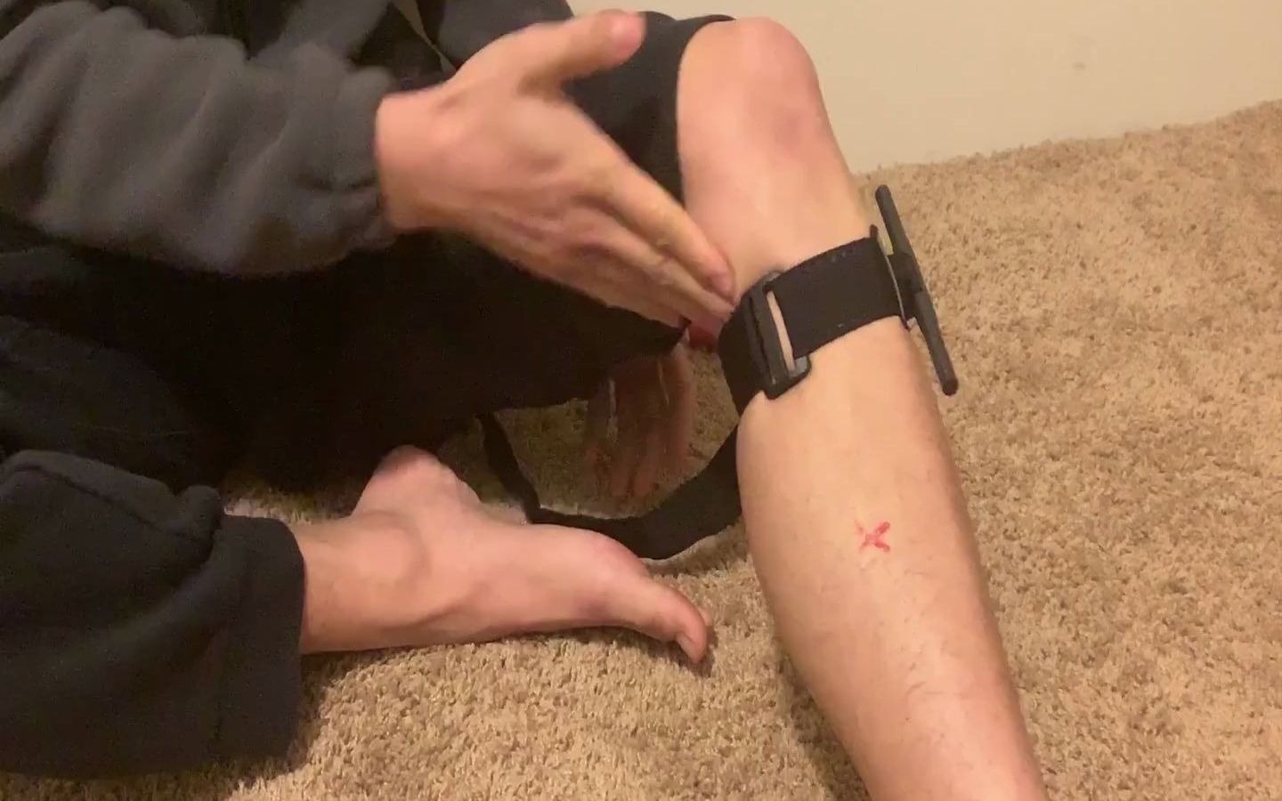 止血带的使用方法