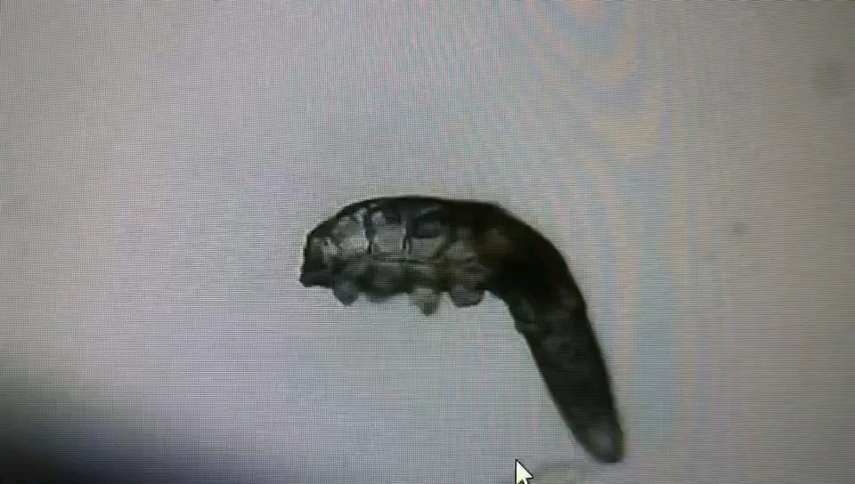 大家一起来找眼部螨虫