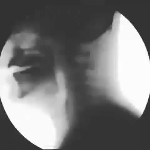 吃东西吞咽的全过程,很快就进入到食管里面#清风计划# @健康真相官