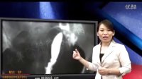 输卵管造影片子怎么看