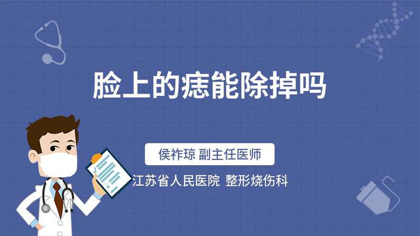 脸上的痣能除掉吗