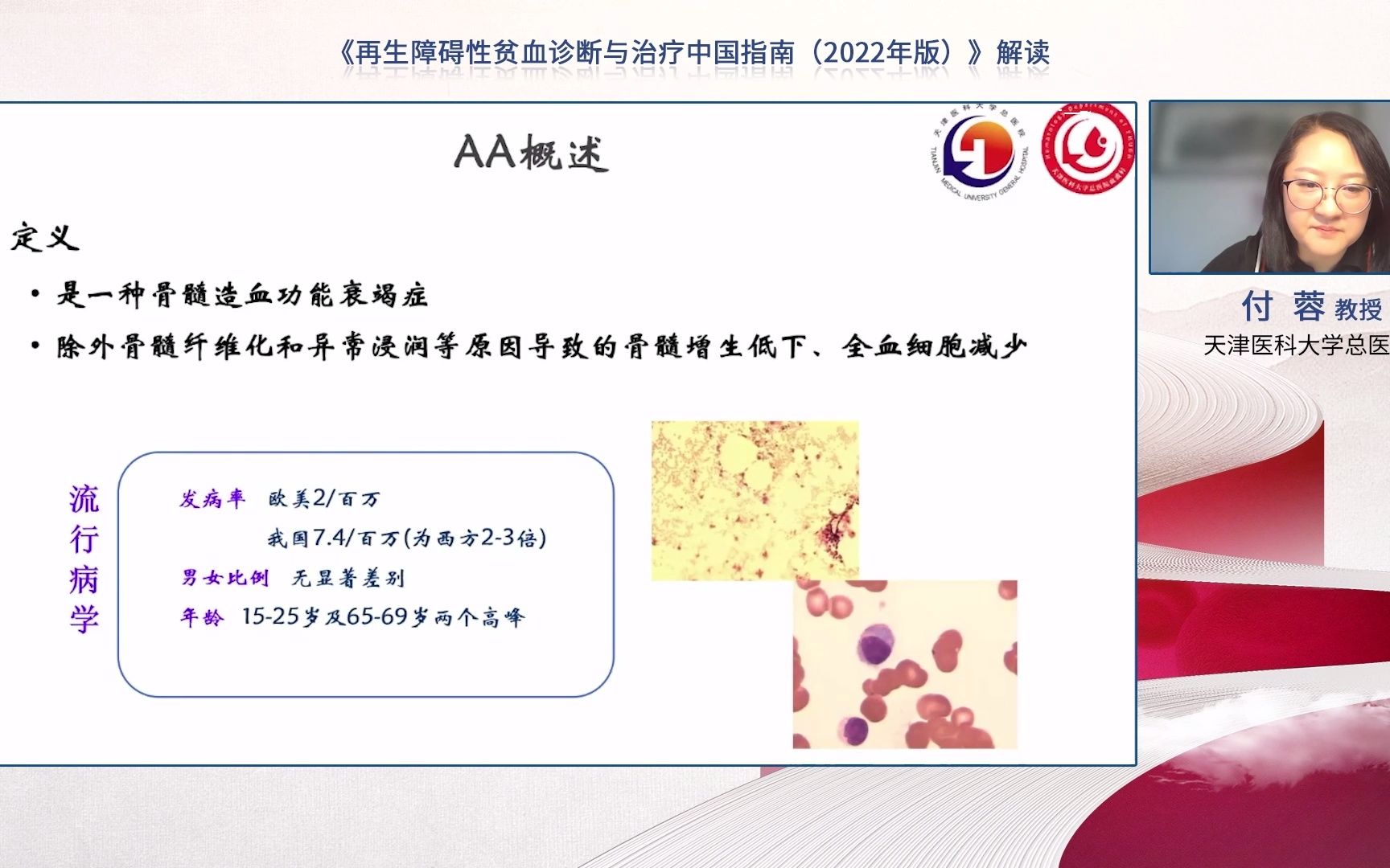 付蓉教授:2022版再生障碍性贫血诊疗指南解读