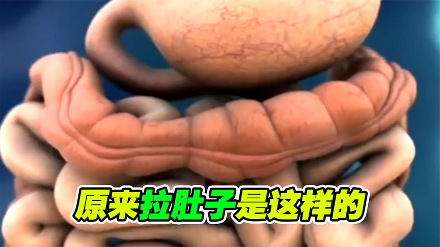 人为什么会拉肚子呢,一个视频带你了解,3D动画演示