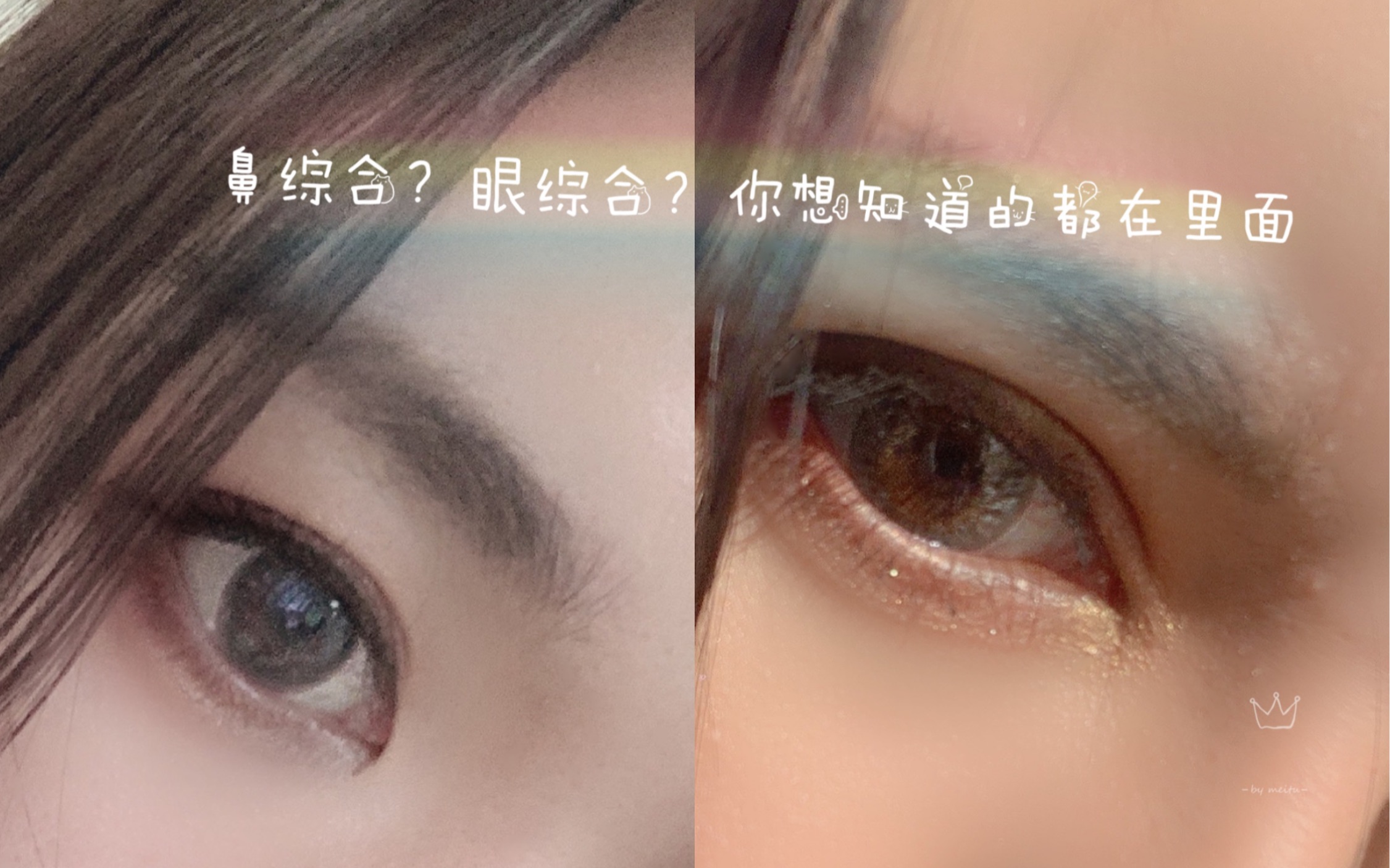 眼鼻综合手术小tips
