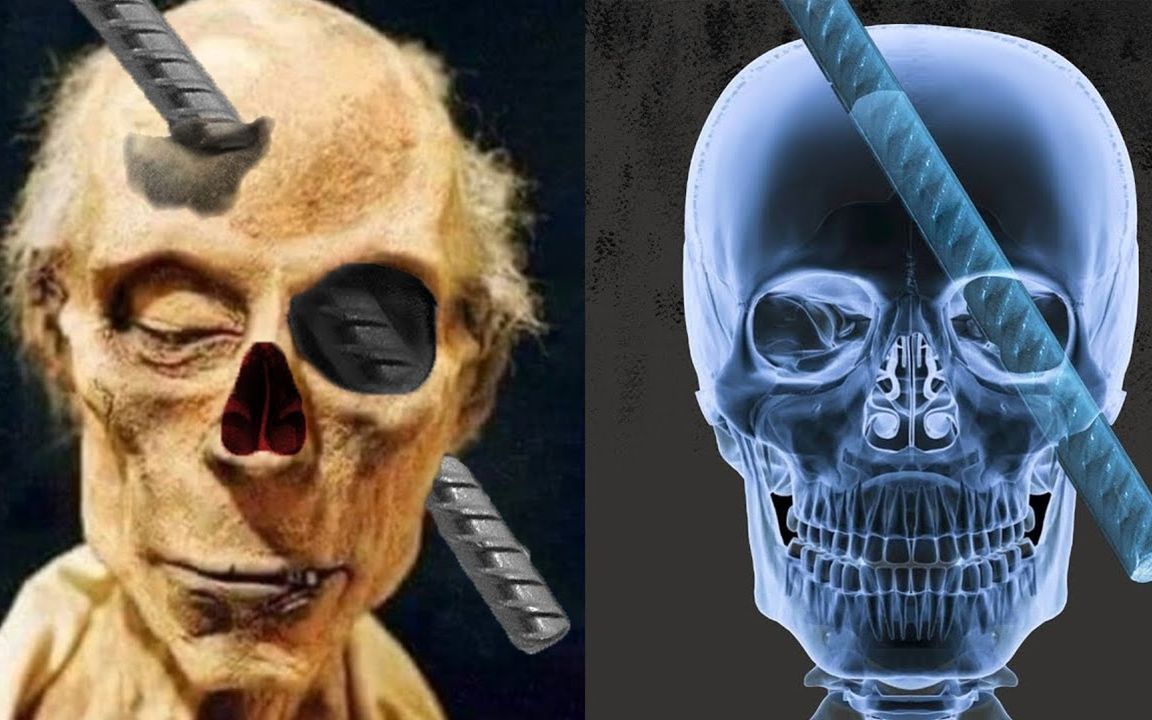 史上最厉害的帝王之一拉美西斯三世到底怎么死的?死因至今是迷