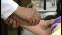 卫生部系列教学片-实用电针疗法-腰扭伤和劳损