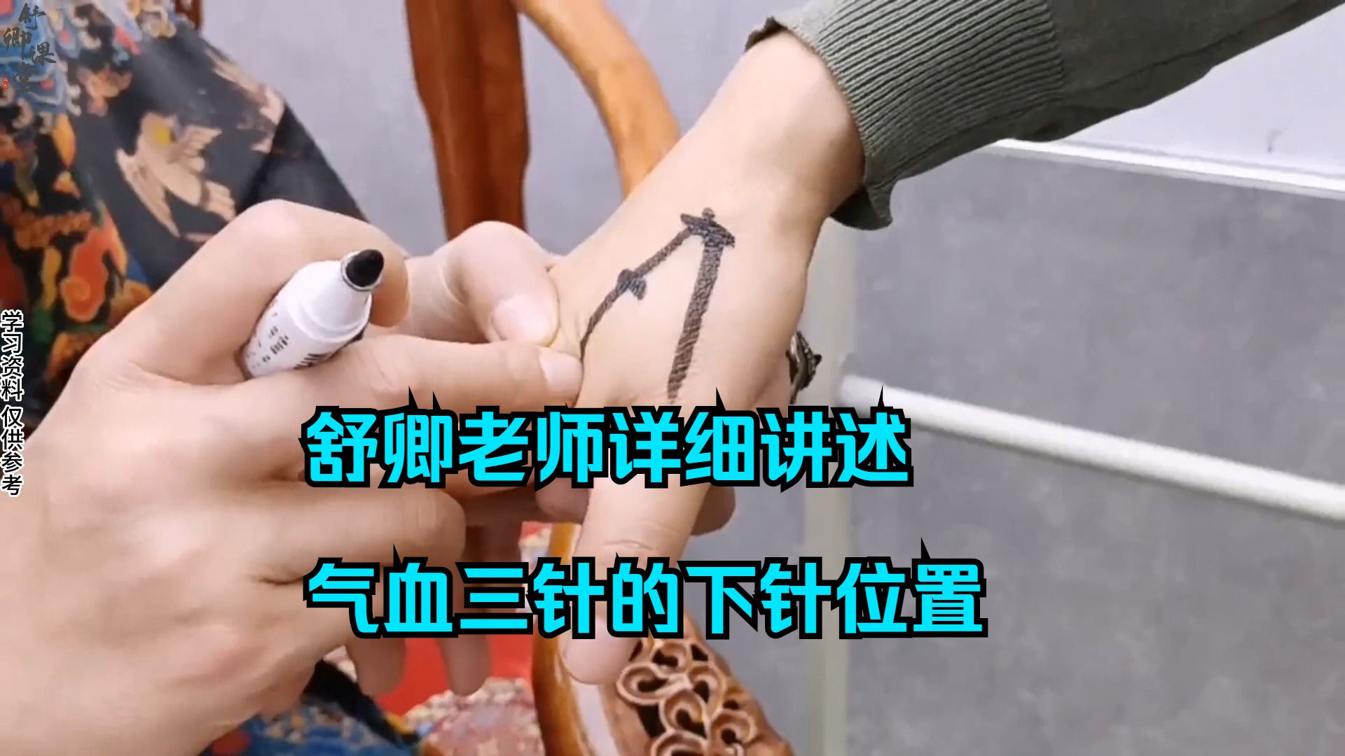 舒卿老师详细讲述气血三针的下针位置