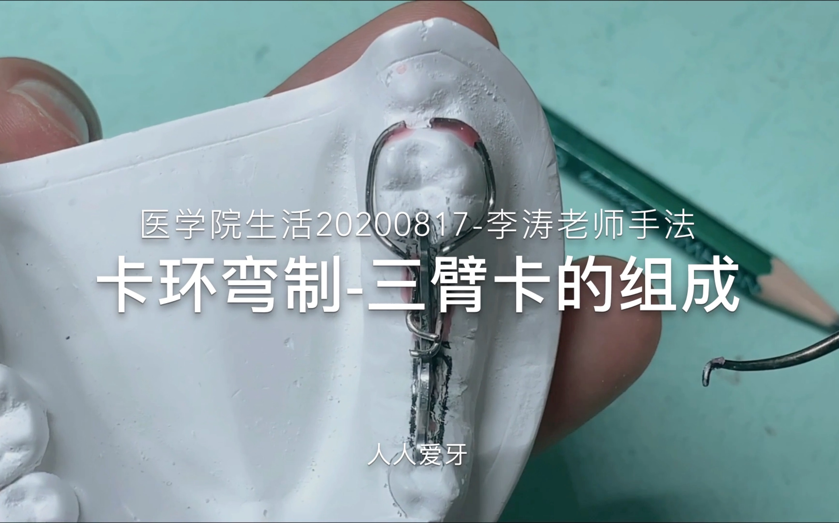 卡环弯制-三臂卡的组成-医学院生活20200817