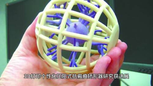 3D打印个性化压阻式抗瘢痕矫形器研究获进展