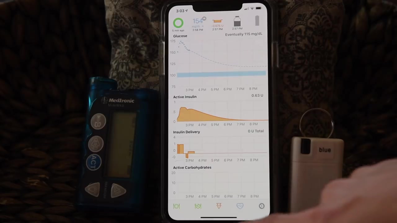 德康G5/G6 美敦力泵 闭环循环简介 An Introduction to Loop