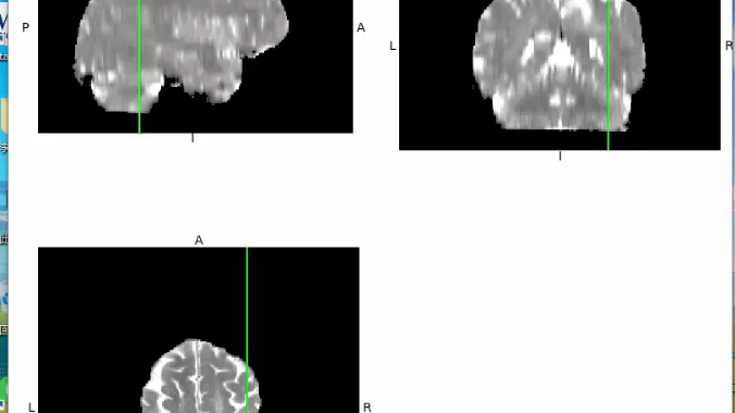 Python 三维重建 MPR