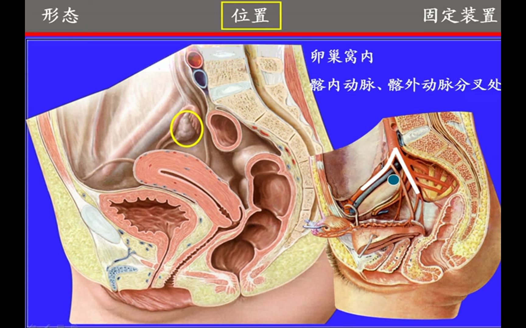 女性生殖系统(卵巢、子宫、输卵管、阴道、会阴)——系统解剖学 局部...