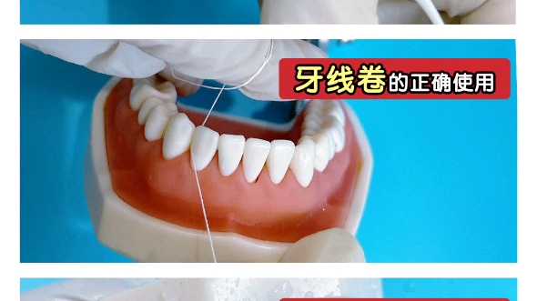 牙线棒‖牙线卷‖冲牙器的正确使用方法分享